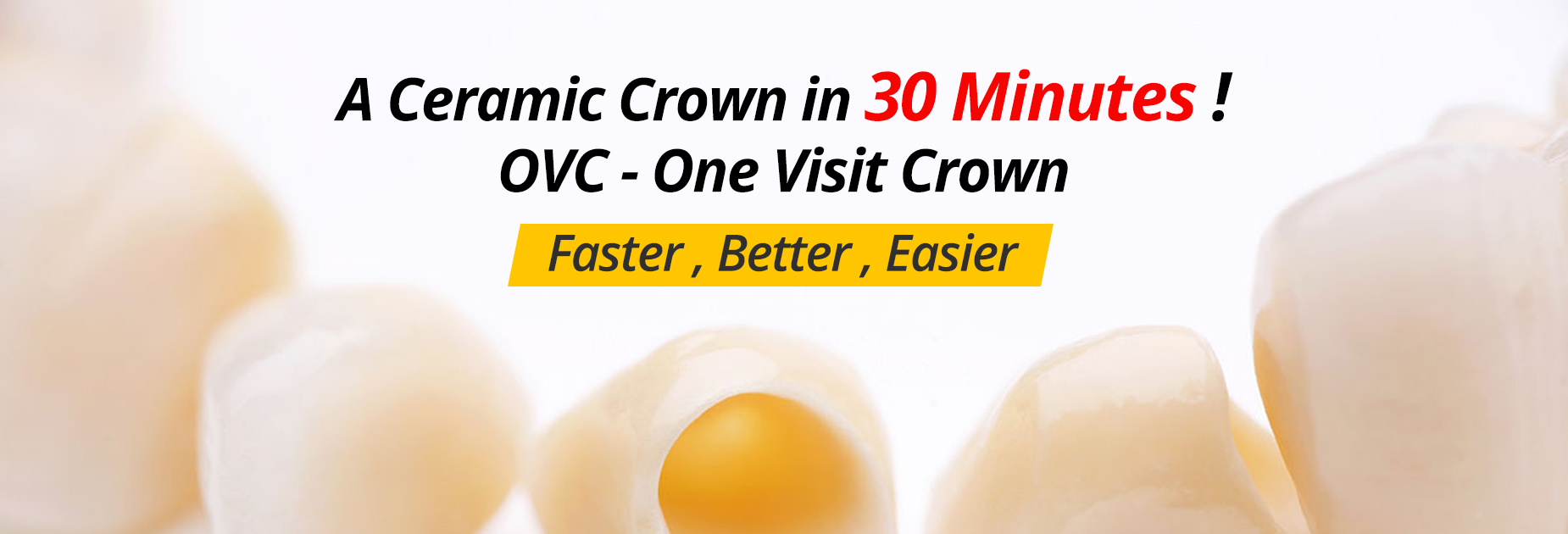 fast crown - Smile Dental